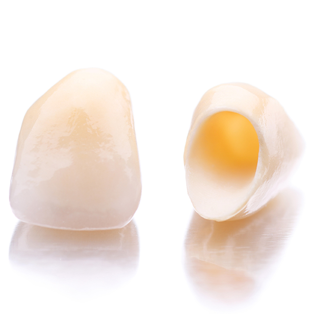 Corones - Dentista a Terrassa i Vilafranca - Dr. J. Ferre